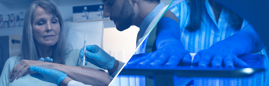 Actinic Keratosis Treatment | LEVULAN® KERASTICK®